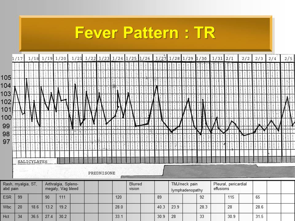 Treatment Preferences in Still’s Disease | RheumNow