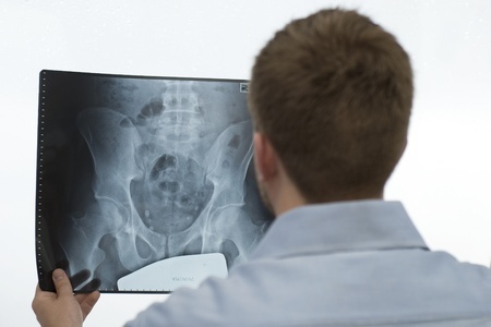 ASAS: MRI Definition of Active Sacroiliitis | RheumNow
