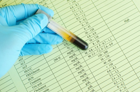 ANCA Levels Predict Relapse in ANCA-Associated Vasculitis | RheumNow