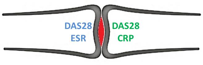 DAS28-CRP or DAS28-ESR: Are they Biosimilar? (Best of 2015) | RheumNow