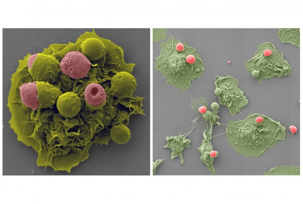 Dynamic Duo Takes Out The Cellular Trash | RheumNow