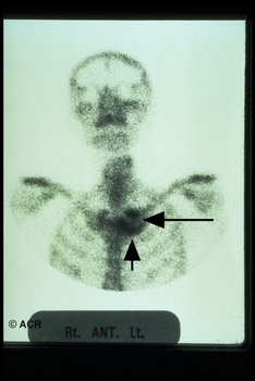 EULAR Recommendations on Imaging for SpA | RheumNow