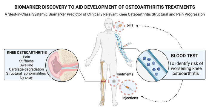 Blood Test Identifies Osteoarthritis Progression | RheumNow