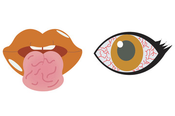It's now called Sjögren Disease! | RheumNow