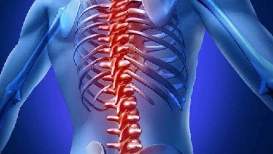 A Rule of Five Spots Spine Disease | RheumNow