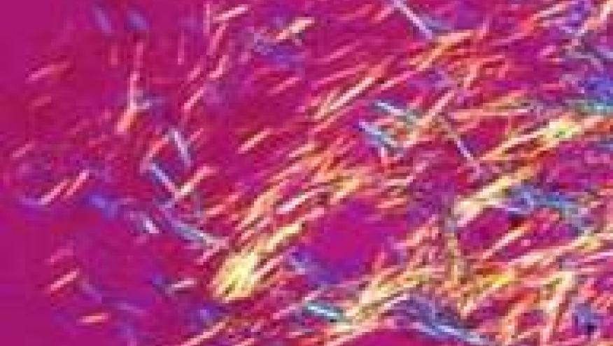 Novel Inhibition of MSU Crystal Inflammation | RheumNow