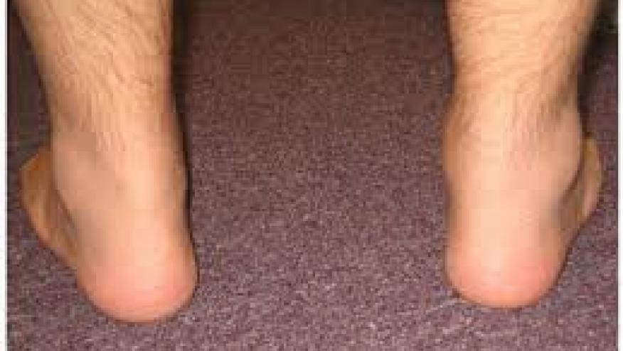 Enthesitis Ultrasound as an Outcome Measure in Spondyloarthritis | RheumNow