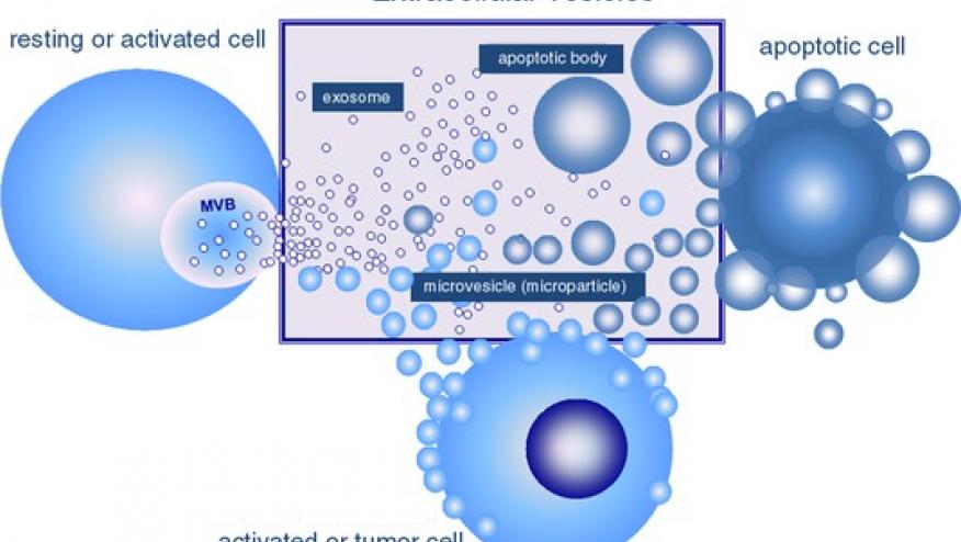 Microvesicles May Ameliorate Arthritis Damage | RheumNow