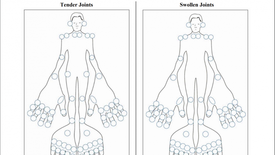 Q-DAPSA for Measuring Disease Activity in PsA | RheumNow