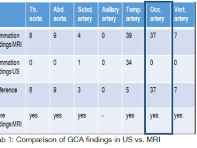 RT @RichardPAConway: Froehlich et al. MRI superior to US in GCA. For ...