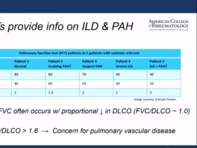 RT @KDAO2011: #RheumPearl FVC:DLCO ratio can be helpful to disting. b/t ...