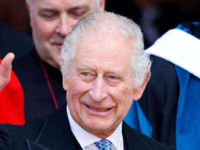 Does King Charles have Sausage Digits (dactylitis) or OA? https://t.co ...